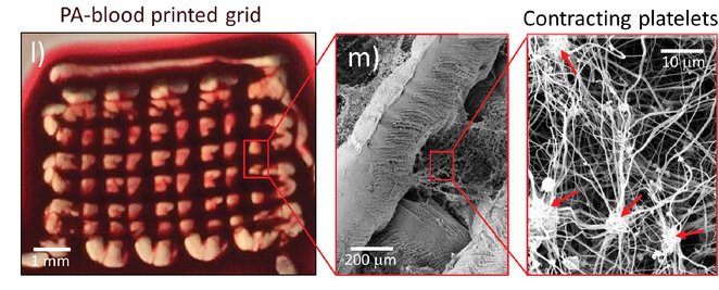 Paper on whole blood based biomaterials published in Advanced Materials ...