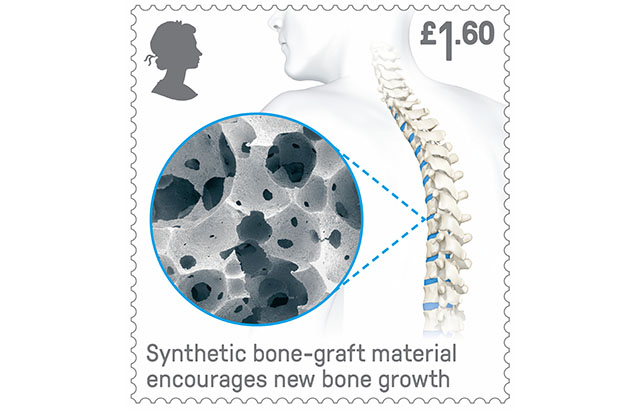Synthetic bone graft research gets stamp of approval: QMUL School of ...