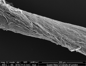 Discovery brings scientists one step closer to understanding tendon ...